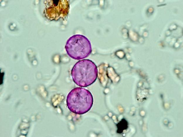 El polen es invisible a simple vista, con la excepción del polen del ...